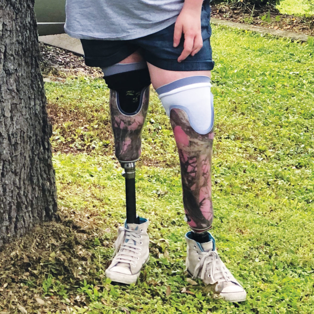 Cranial Remolding | Scoliosis Braces | Pectus Carinatum