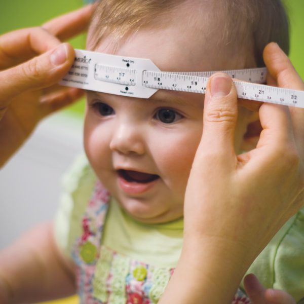 Cranial Helmet Spotlight - Mia Grace | Westcoast Brace and Limb