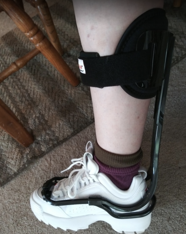 Bilateral TurboMed XTERN AFO's - Annette's Story | Testimonials