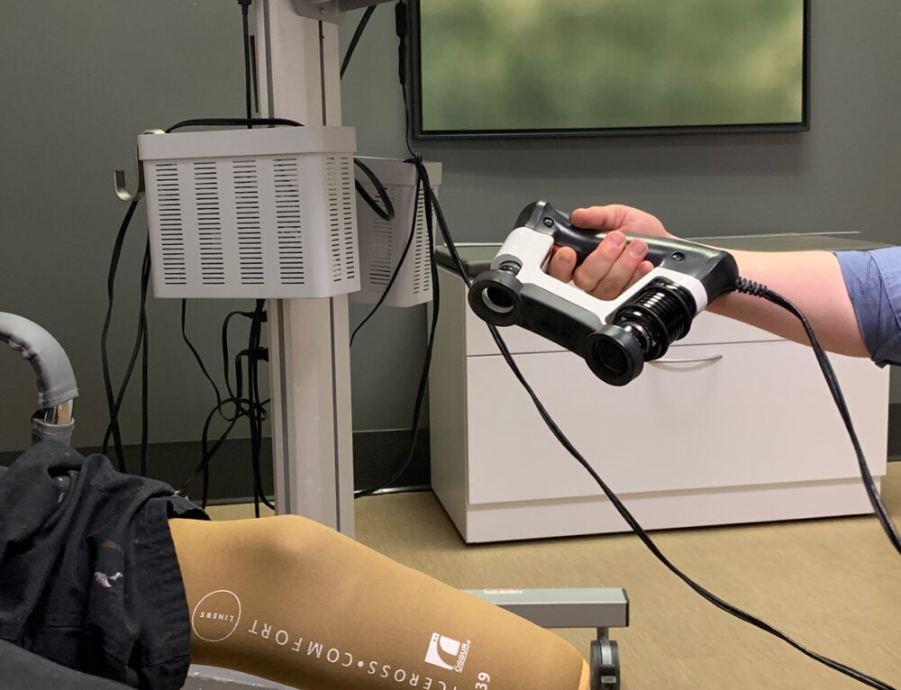 Drop Foot made simple with the TurboMed XTERN AFO | News