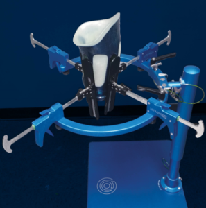 HiFi Interface Technology – Prosthetic Socket | West Coast & Brace