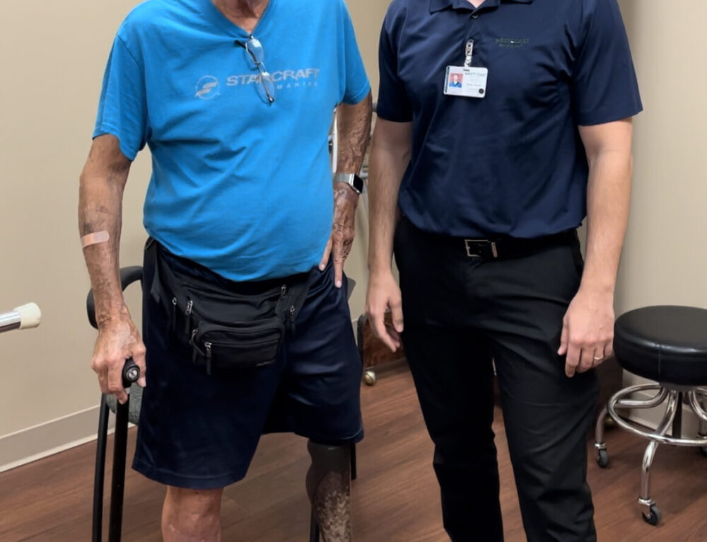 How Do Prosthetic Arms Work