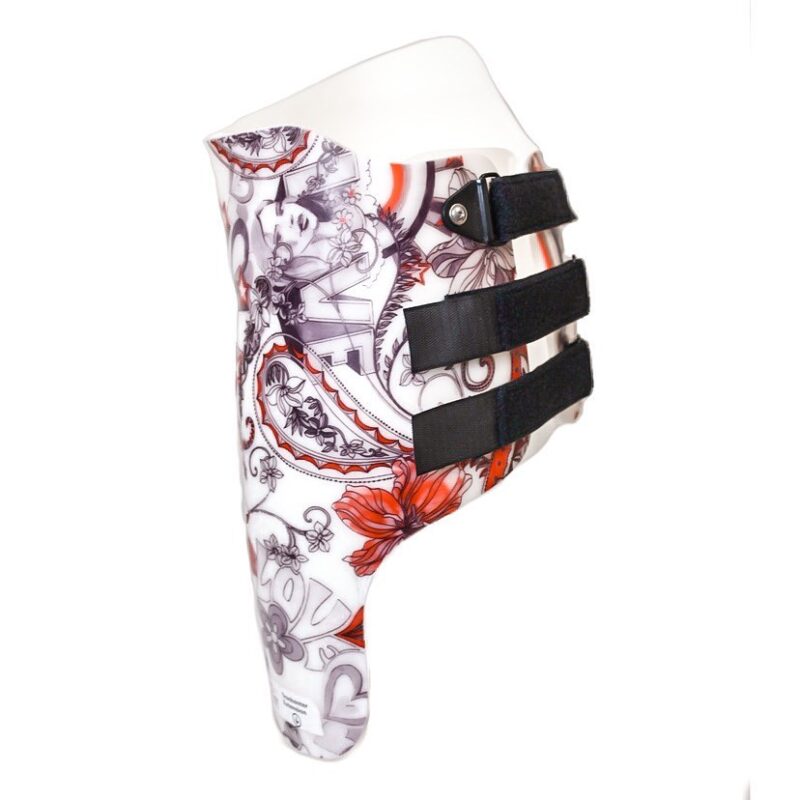 Scoliosis Bracing | Scoliosis Awareness | Westcoast Brace & Limb