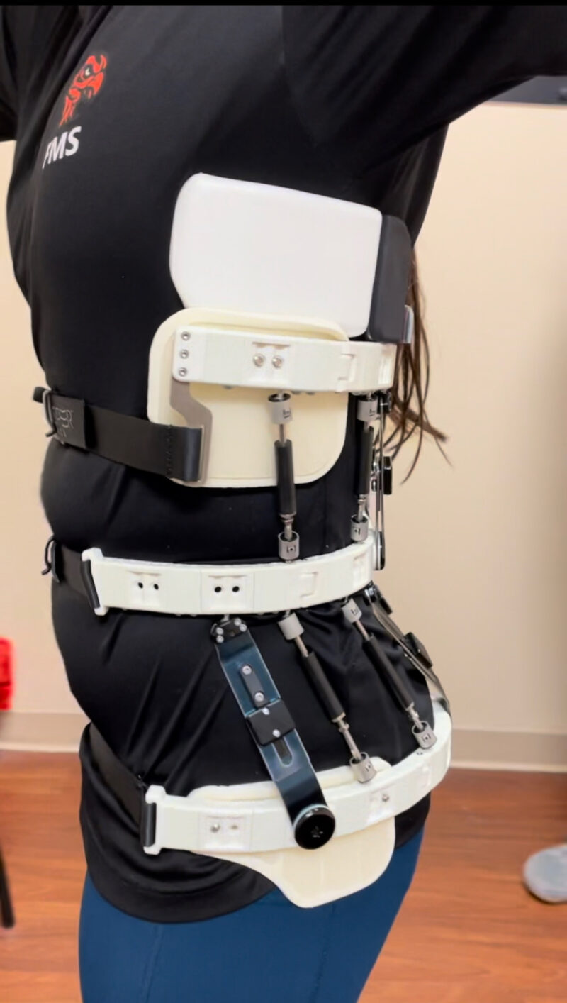 Scoliosis Bracing | Scoliosis Awareness | Westcoast Brace & Limb