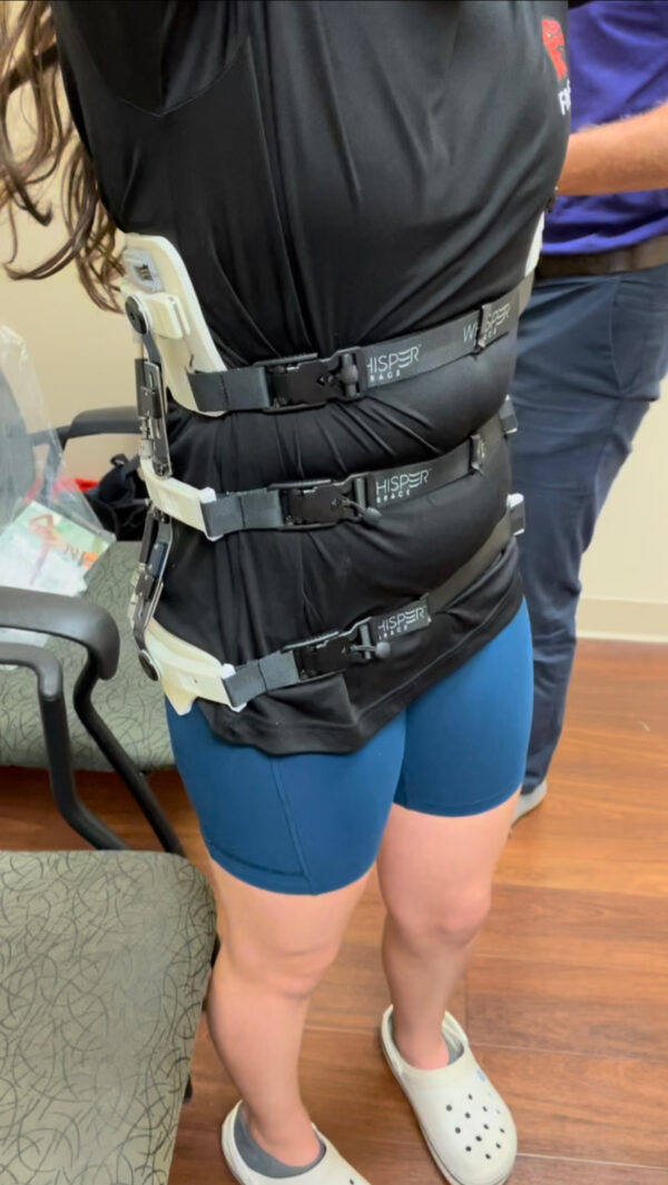 Scoliosis Bracing | Scoliosis Awareness | Westcoast Brace & Limb