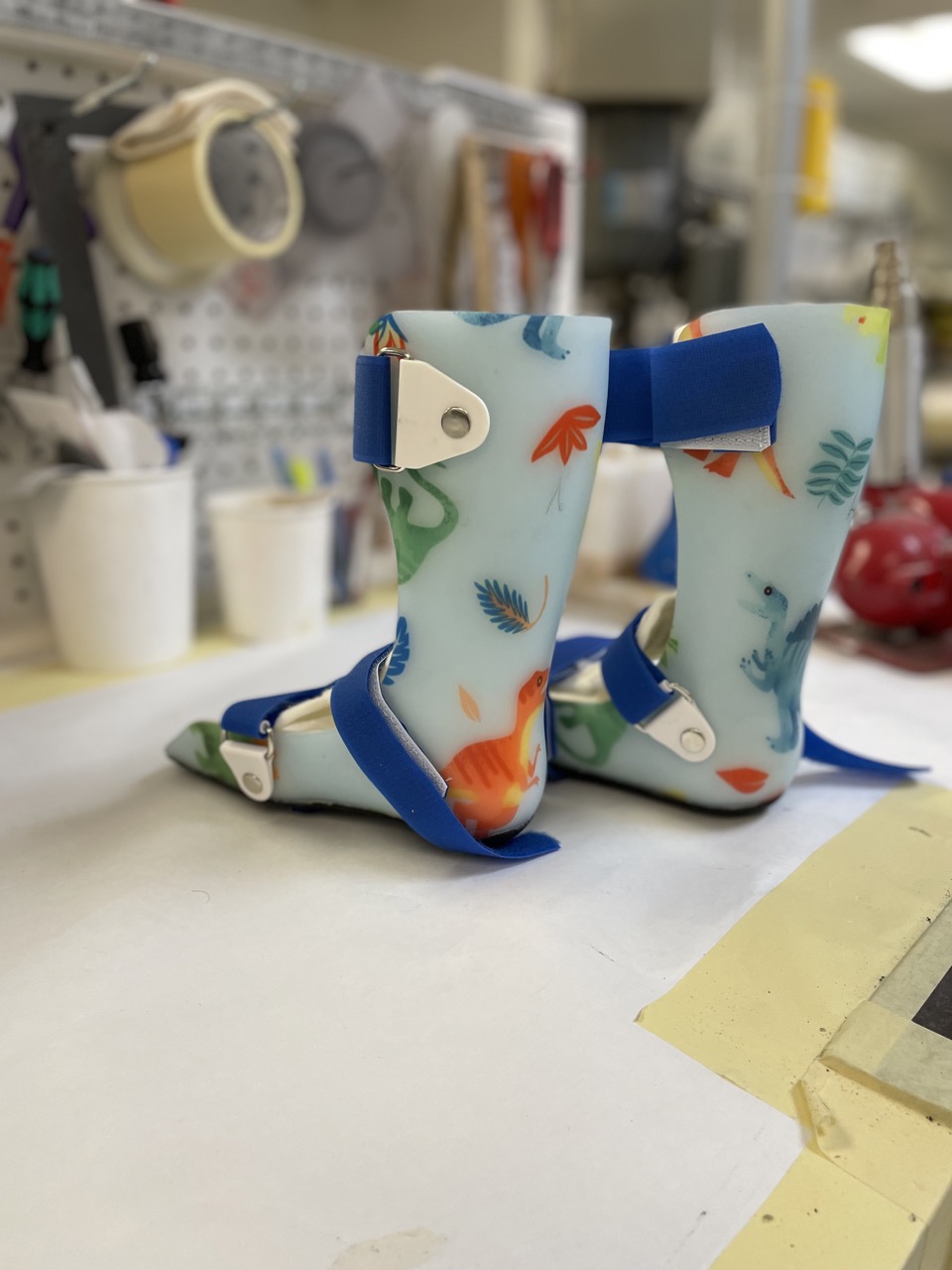 Ankle Foot Orthosis (AFO) | Westcoast Brace and Limb | Florida ...