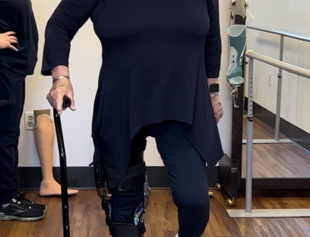 How Do Prosthetic Arms Work