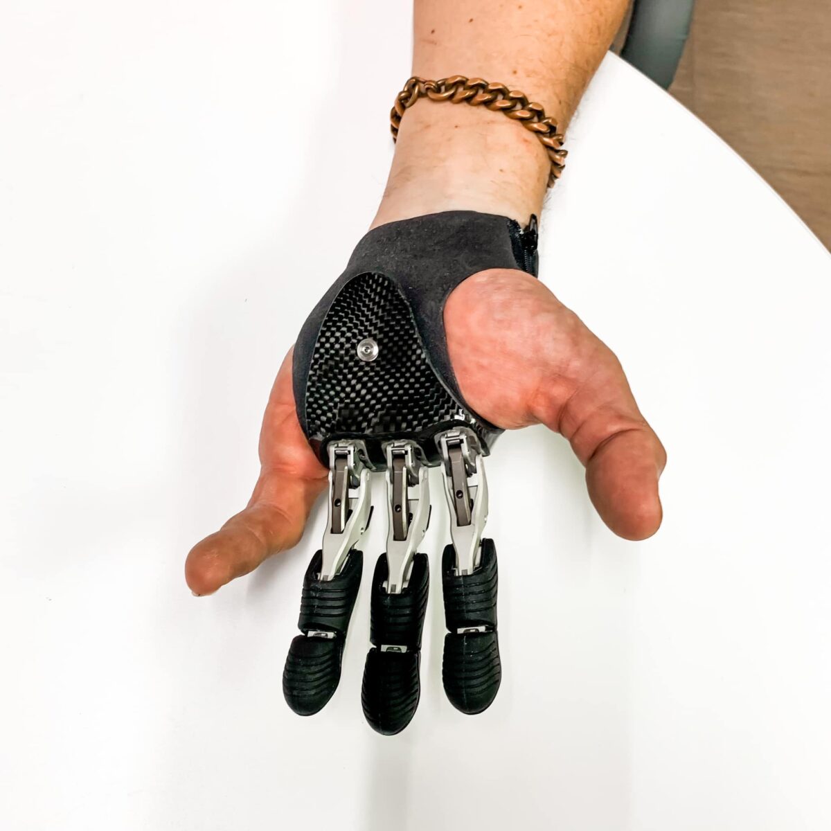 Finger Prostheses - All About Function | Westcoast Brace and Limb ...