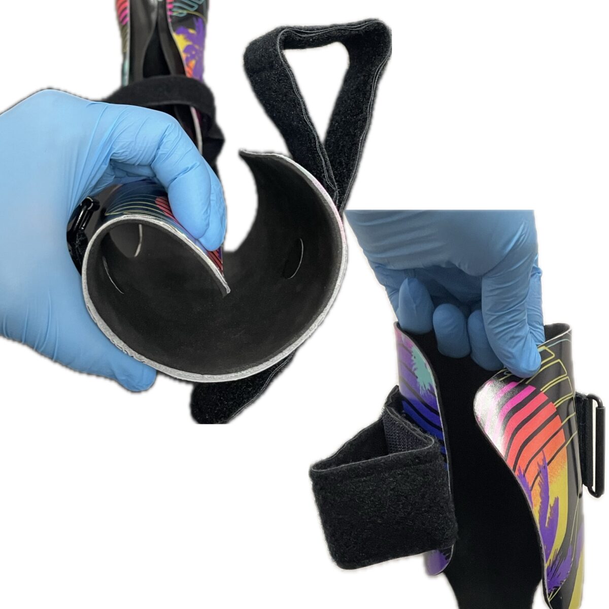 Prosthetic Orthotic Central Fabrication Services | WCBL