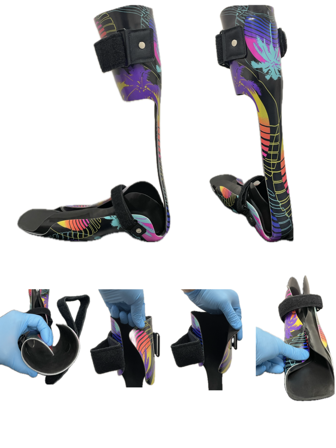 Optimizing Mobility with Flexible Pre-Preg AFOs | Westcoast Brace and ...
