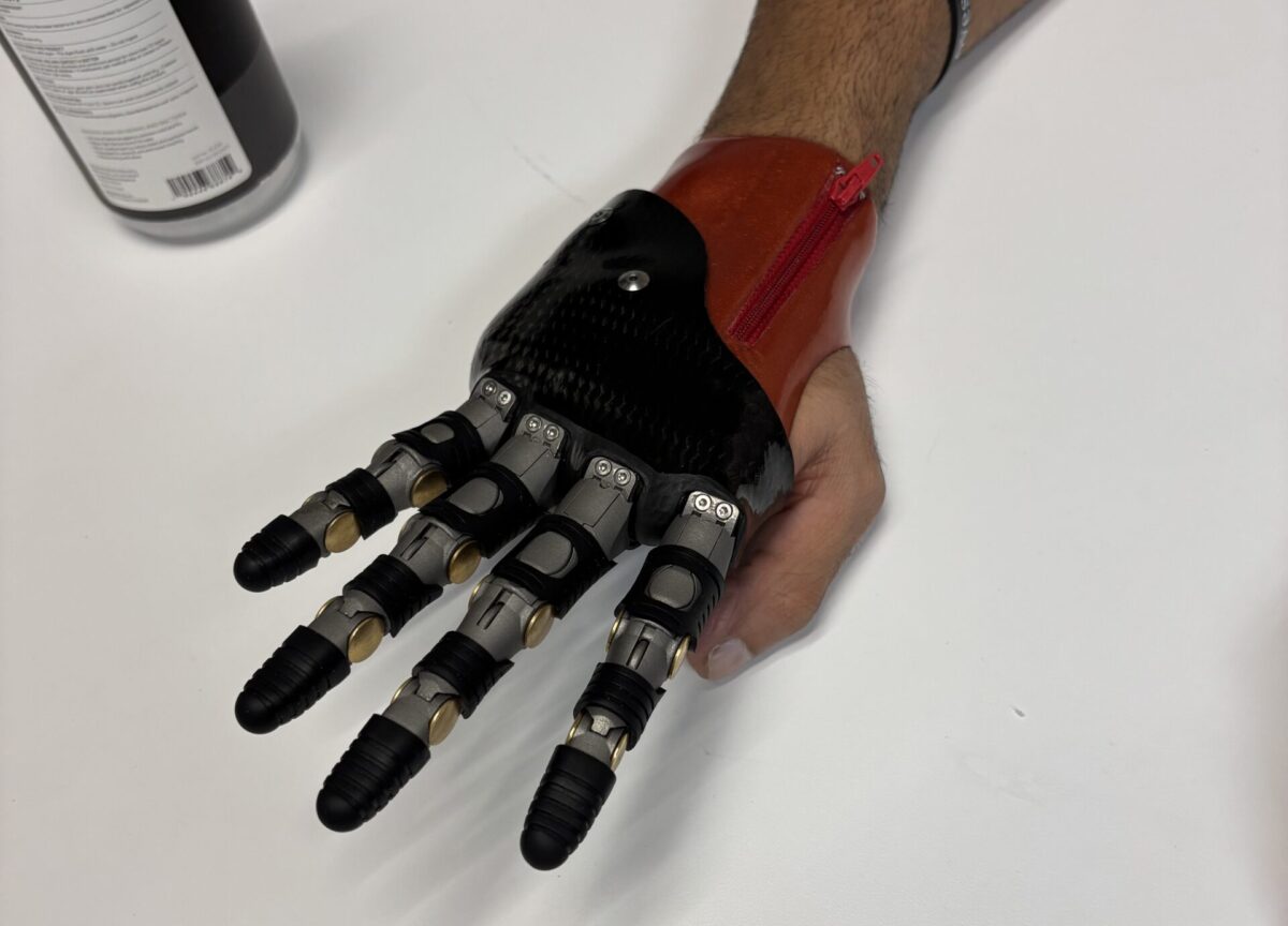 Partial hand and finger prosthetics | Westcoast Brace and Limb ...
